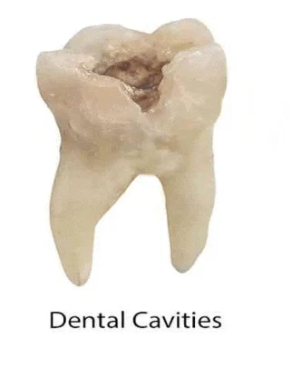 Dental Cavities Meme Meme - Share & View on KLIPY